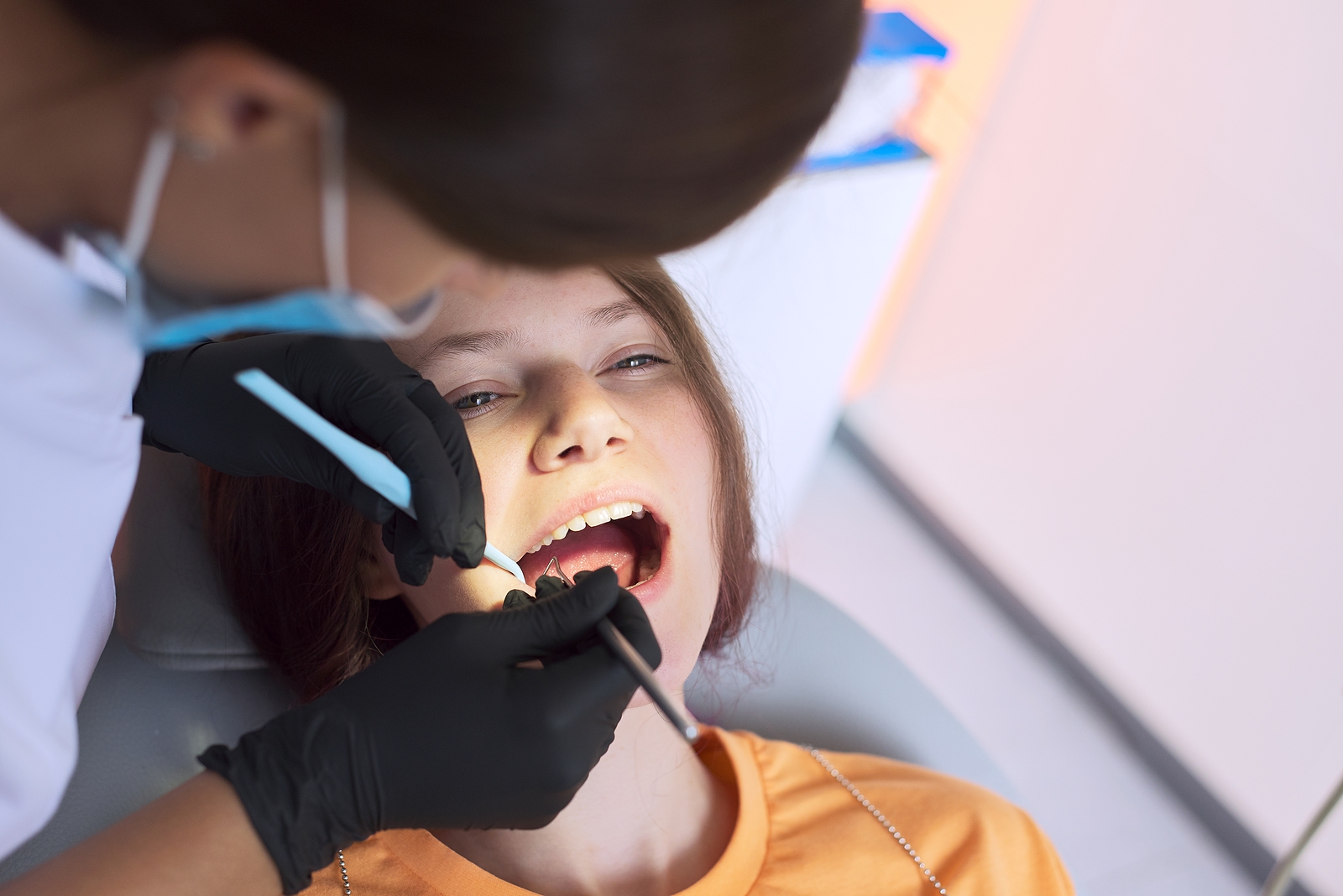 Use of Silver Diamine Fluoride in Arresting Caries – Part 2 – Oasis ...
